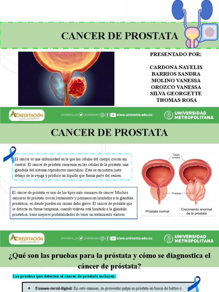 Cancer de Prostata | PDF | Cancer de prostata | Cáncer