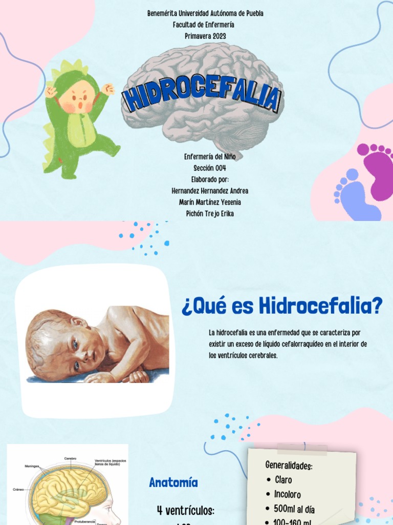 Hidrocefalia_Enfermería Del Niño | PDF | Fluido cerebroespinal ...