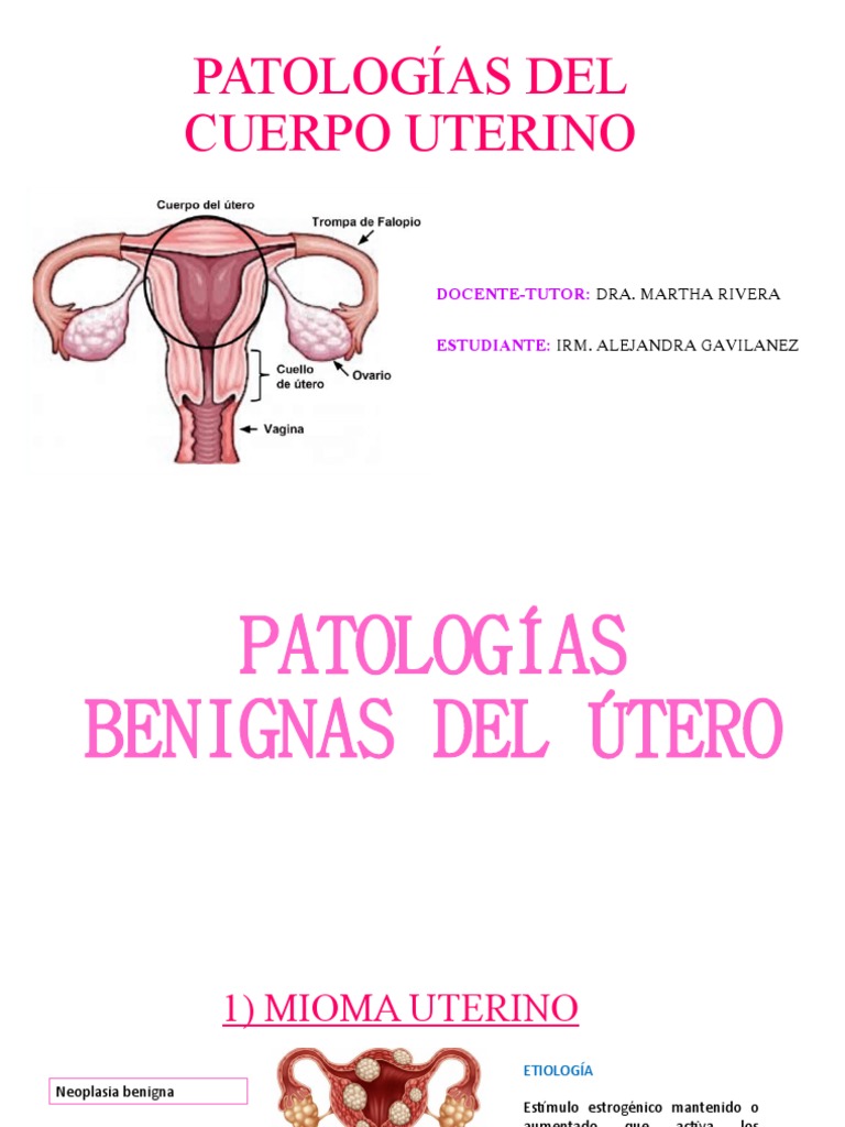 Patologías Del Útero | PDF | El embarazo | Útero