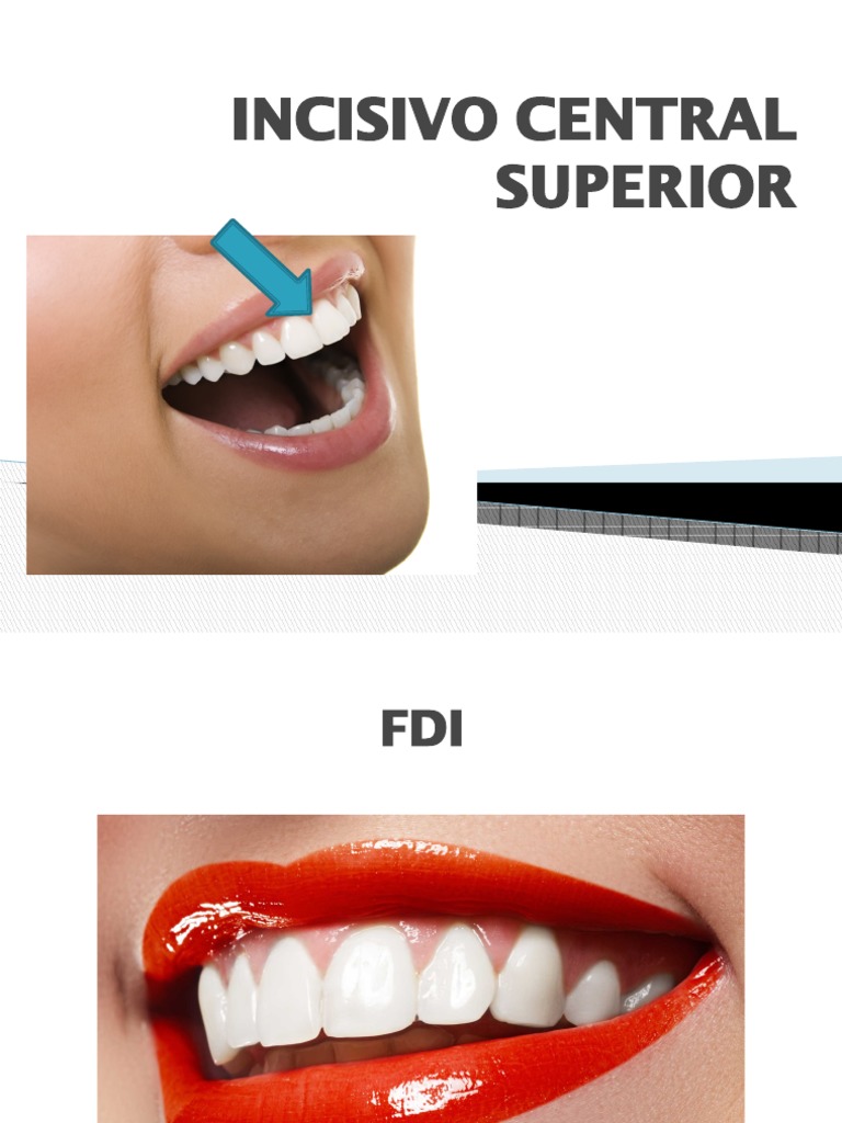 Anatomía del Incisivo Central Superior | PDF | Anatomia dental