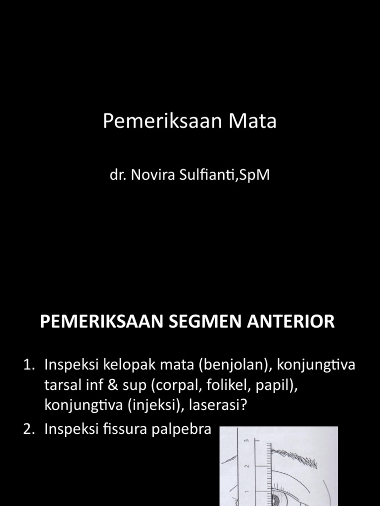 Pemeriksaan Mata | PDF