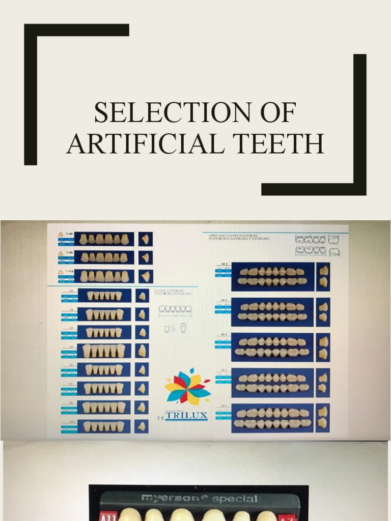 Tooth Selection | PDF | Dentures | Dental Anatomy