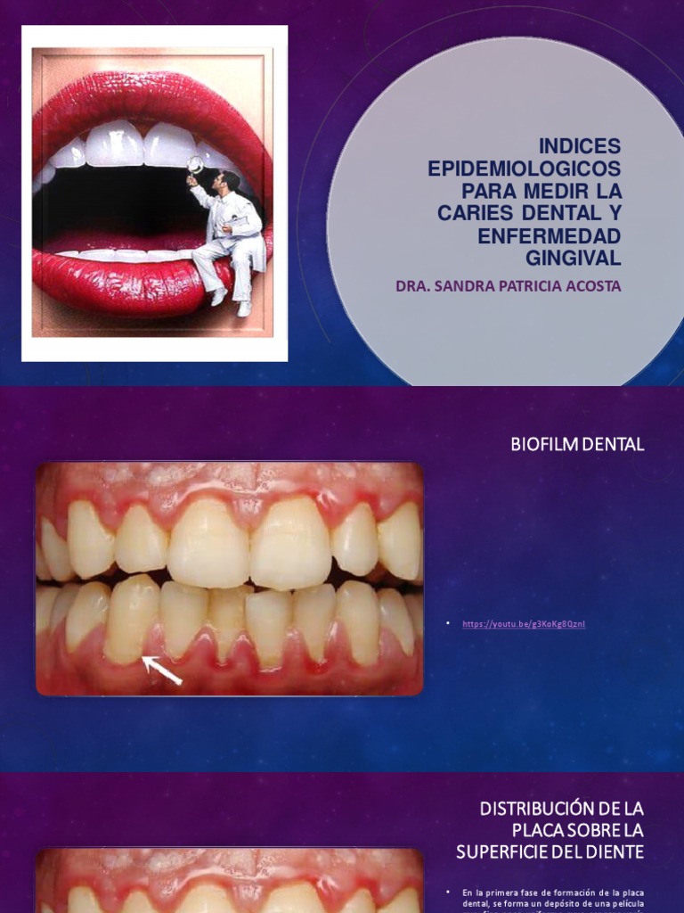 INDICE DE PLACA BACTERIANA | PDF | Medicina | Boca