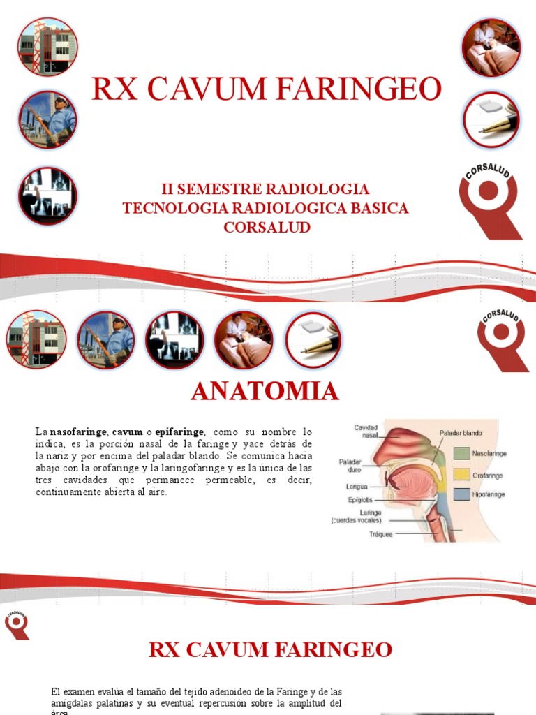 Radiografía de Cavum Faríngeo en Niños | PDF