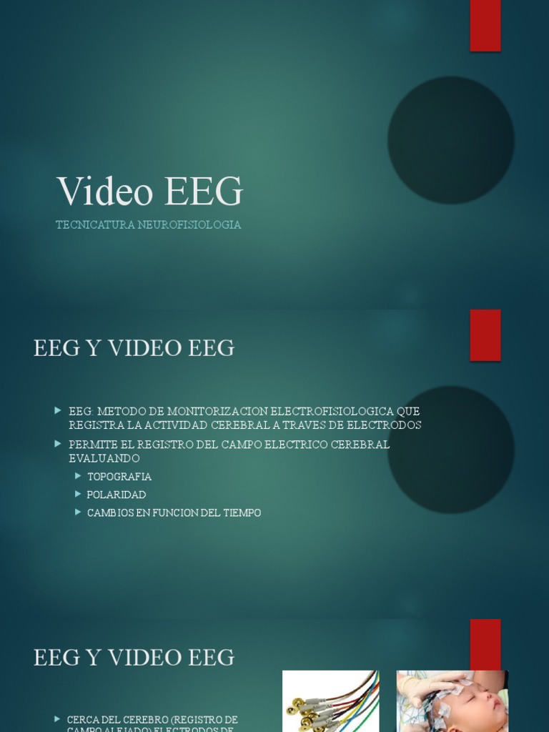Video EEG | PDF | Epilepsia | Enfermedades y trastornos