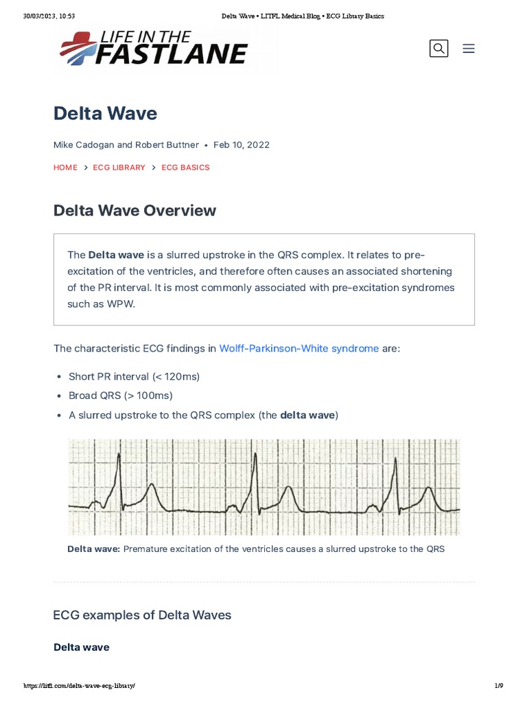 Delta Wave ECG Basics Guide | PDF | Medical Specialties | Causes Of Death