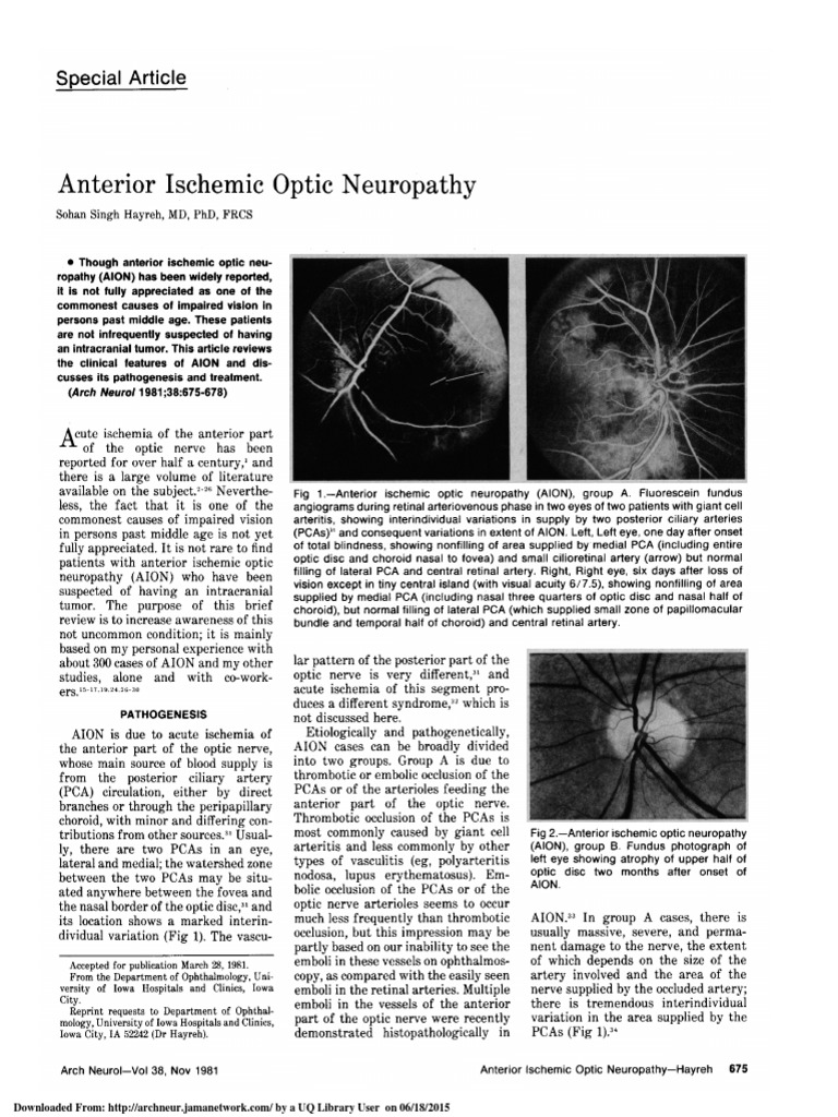 Anterior Ischemic Optic Neuropathy | PDF | Diseases And Disorders | Vision