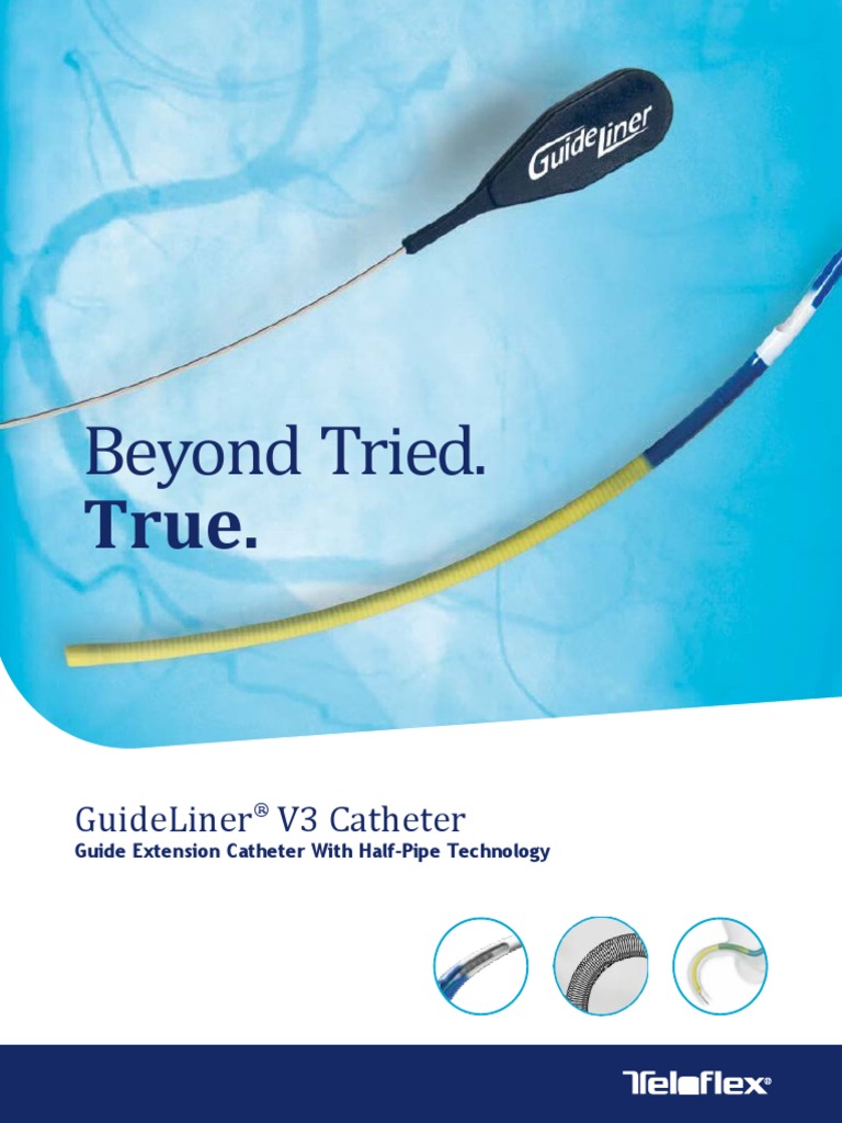 GuideLiner Product Brochure MC 003856 Rev 0.1 | PDF
