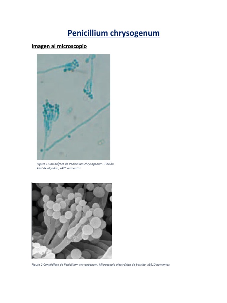 Penic I Llium | PDF