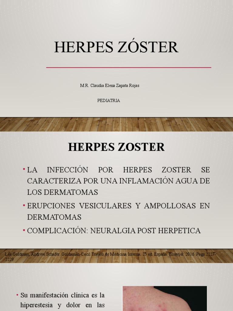 Herpes Zoster | PDF | Inmunología | Condiciones cutáneas