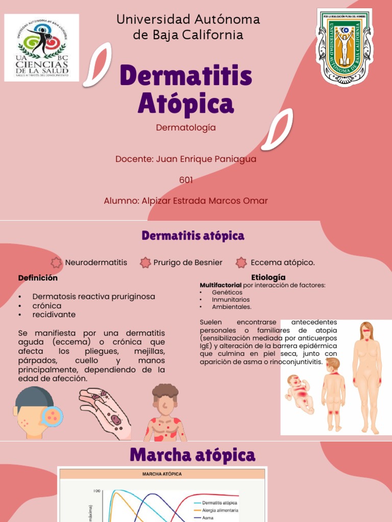 Dermatitis Atopica | PDF | Especialidades Medicas | Medicina CLINICA