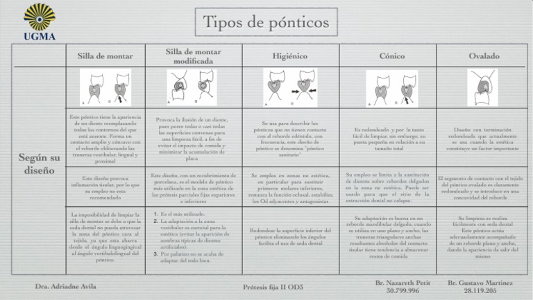 Tipos de Ponticos | PDF | Dentadura postiza | Diente