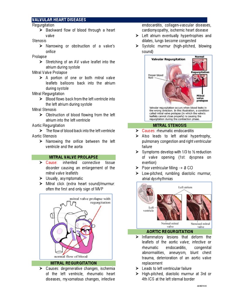 VALVULAR HEART DISEASES Transes Prelims | PDF | Heart Valve | Cardiology