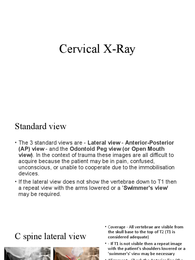 Cervical X-Ray | PDF | Vertebra | Vertebral Column