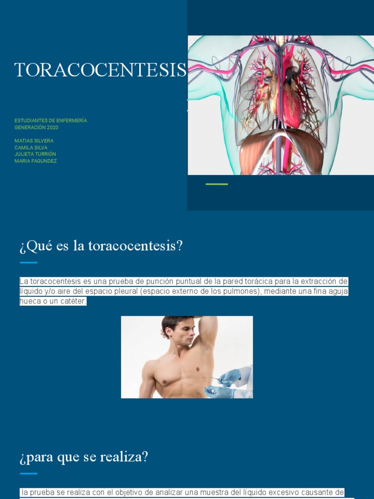 TORACOCENTESIS | PDF | Medicina CLINICA | Especialidades Medicas