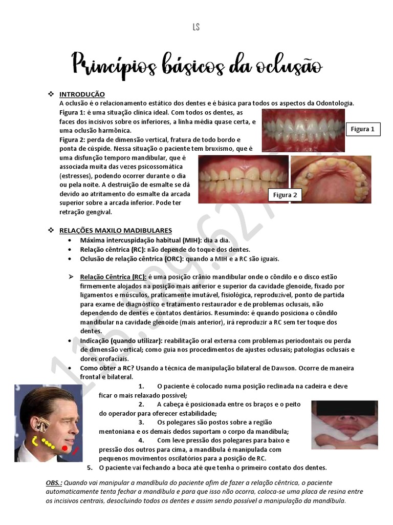 Resumo Princípios Básicos Da Oclusão | PDF