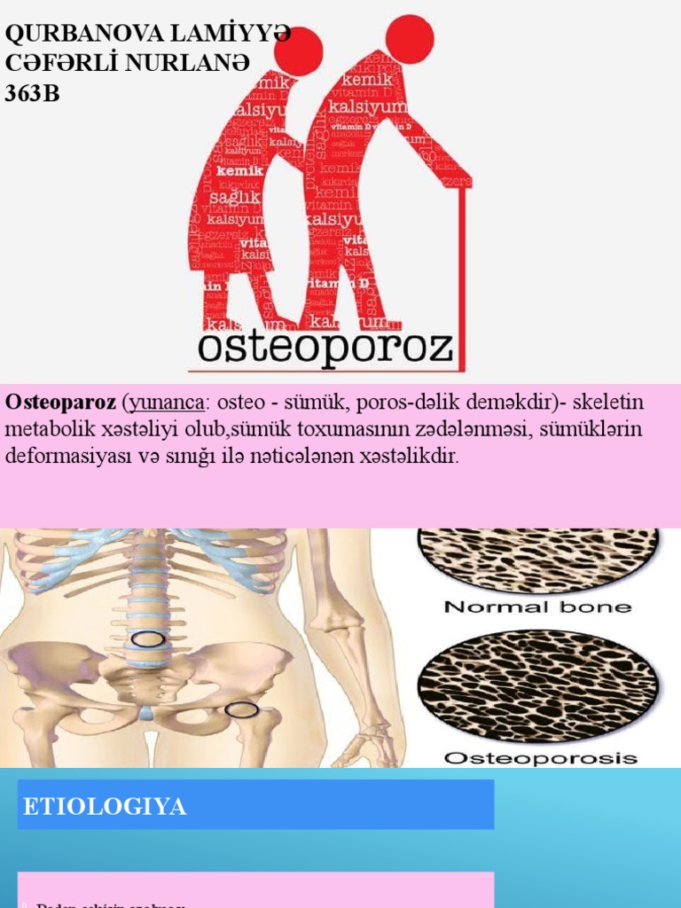 Osteoporoz-Nurlana and Lamia | PDF