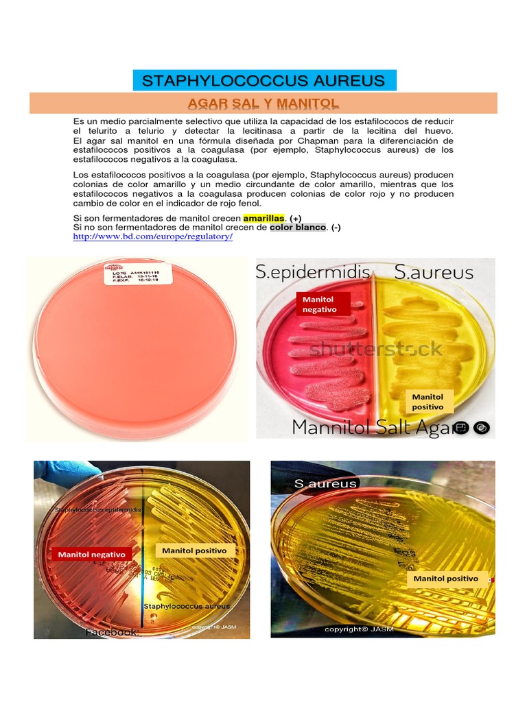 Staphylococcus Aureus | PDF | Organismos | Microbiología