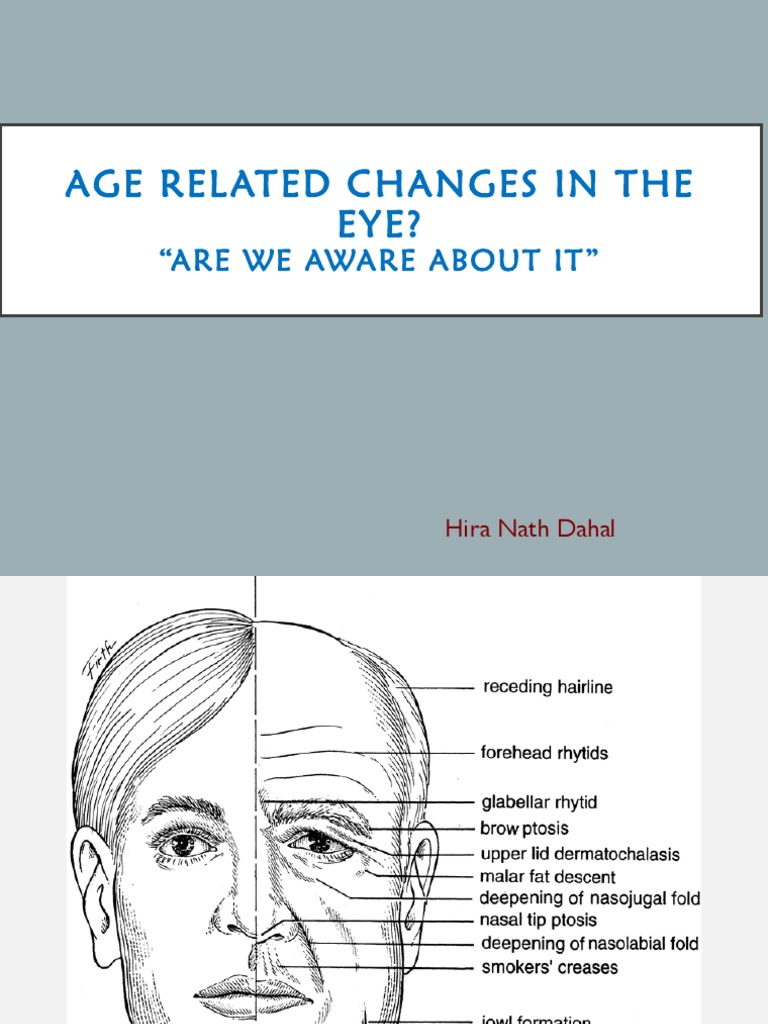 Age-Related Eye Changes Explained | PDF | Human Eye | Cornea