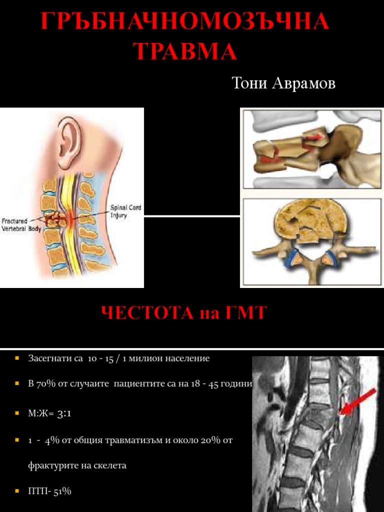 Spinal Trauma - Lection | PDF