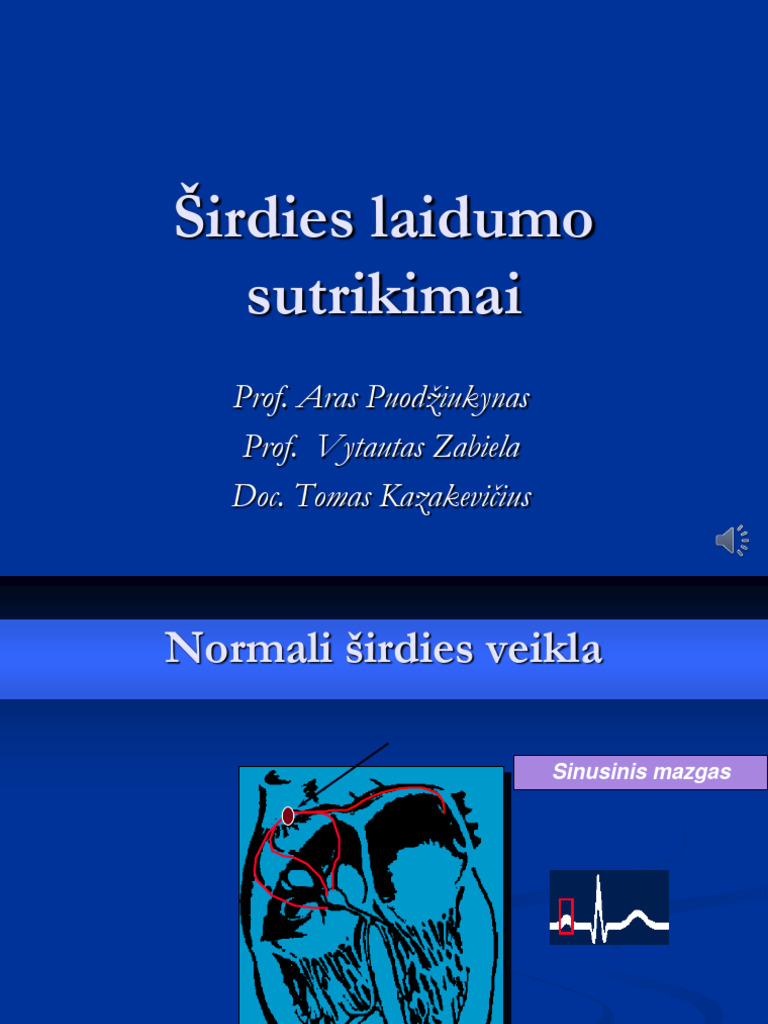 Sirdies Laidumo Sutrikimai 4k 2020 | PDF