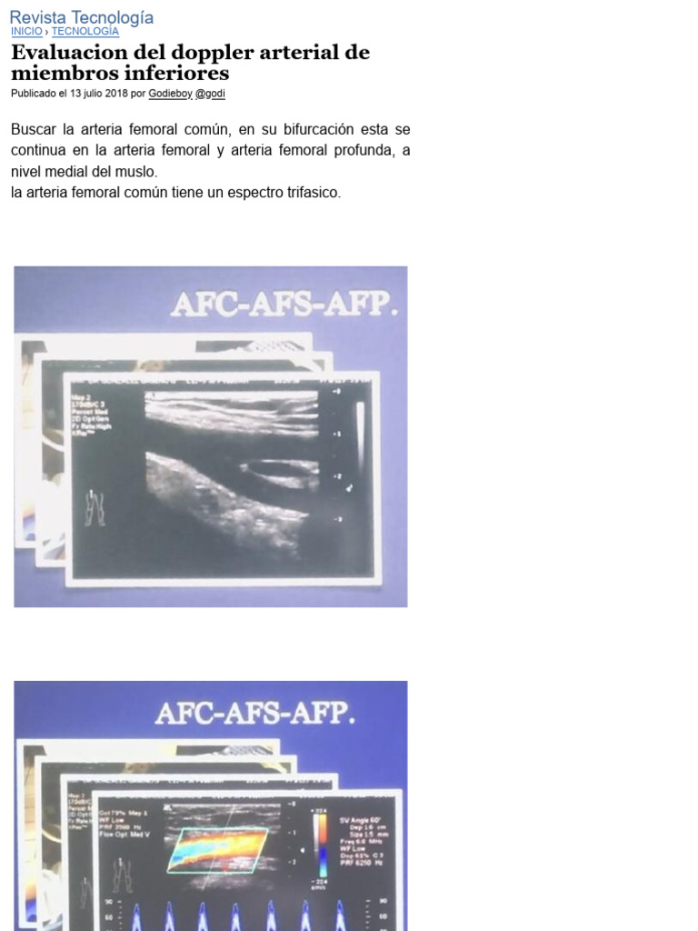 Evaluacion Del Doppler Arterial De Miembros Inferiores Paperblog