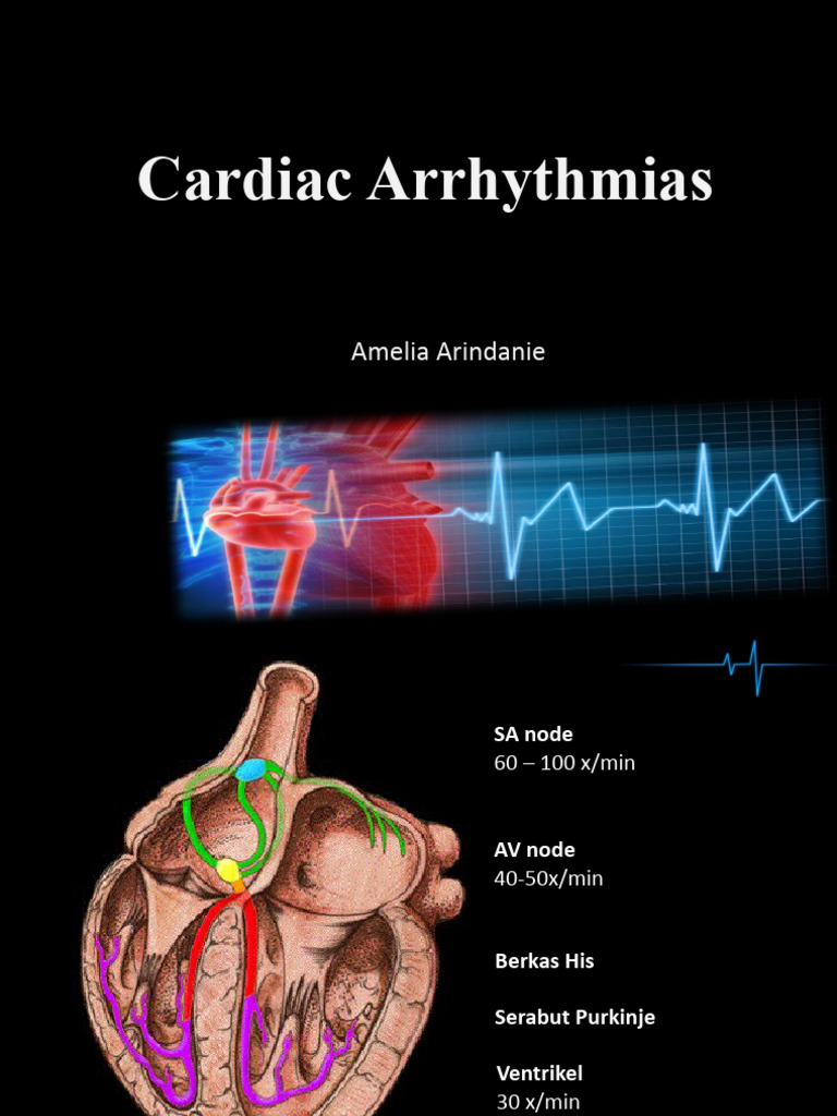 ARITMIA | PDF | Thorax (Human Anatomy) | Circulatory System