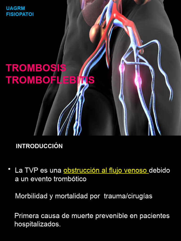Trombosis-Tromboflebitis 2023 | PDF | Trombo | Angiología