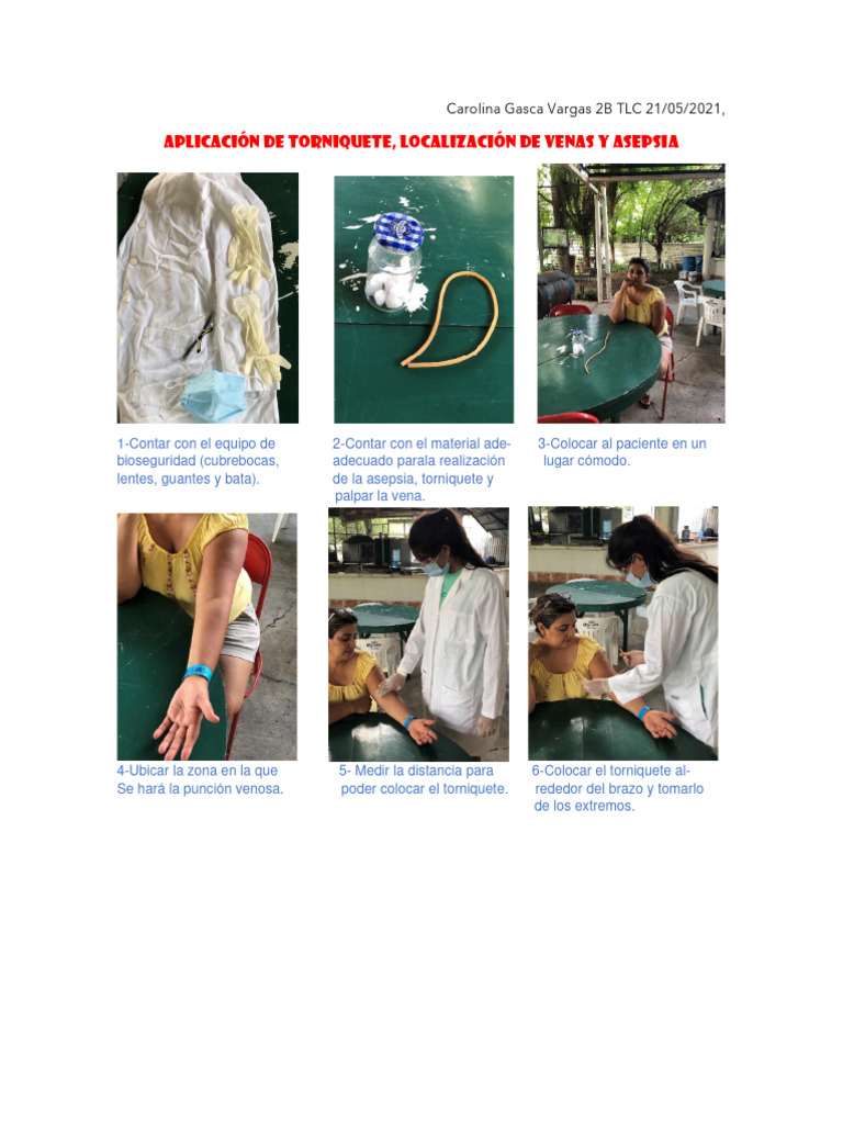 Aplicación de Torniquete y Asepsia Venosa | PDF