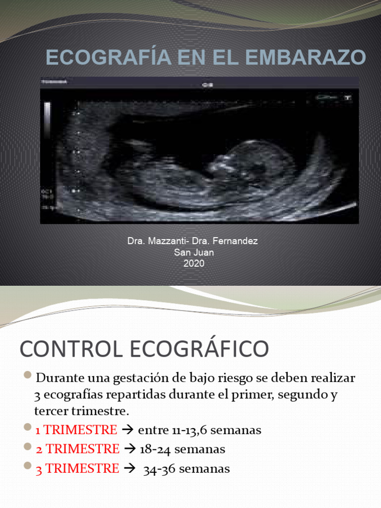 4 - Ecografía en El Embarazo | PDF | El embarazo | Feto