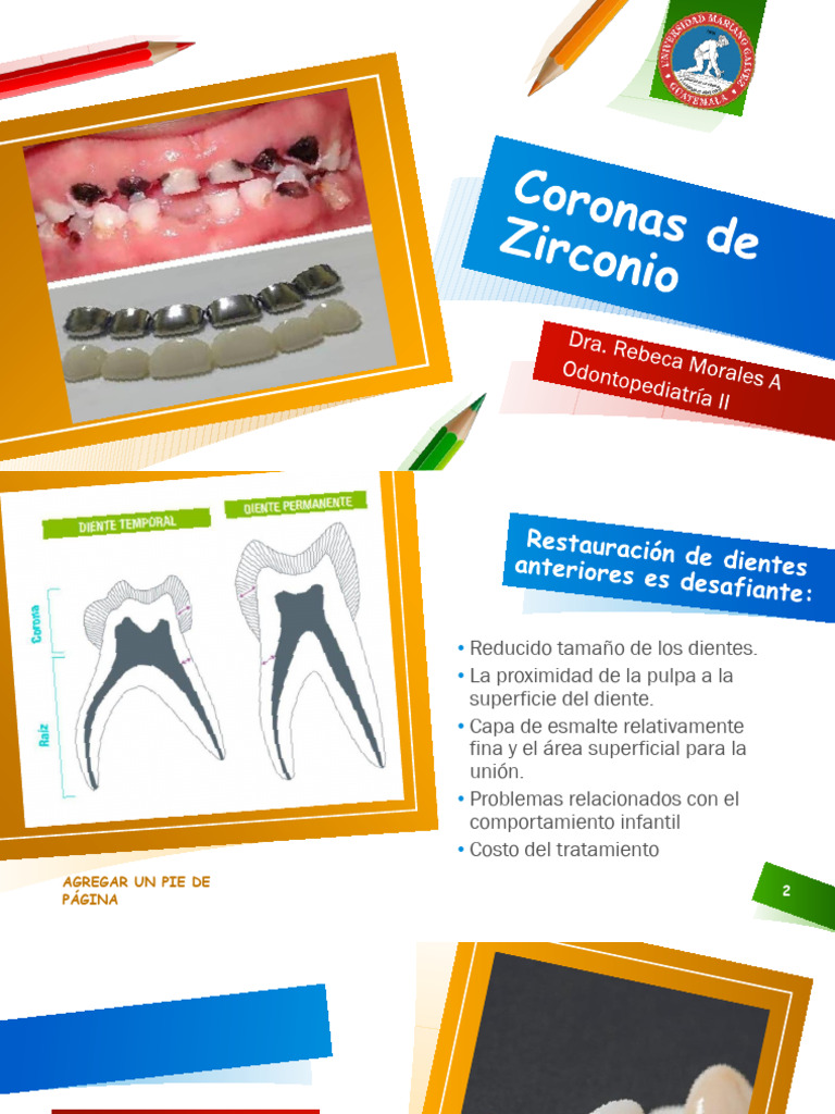 Coronas de Zirconio | PDF | Diente | Materiales