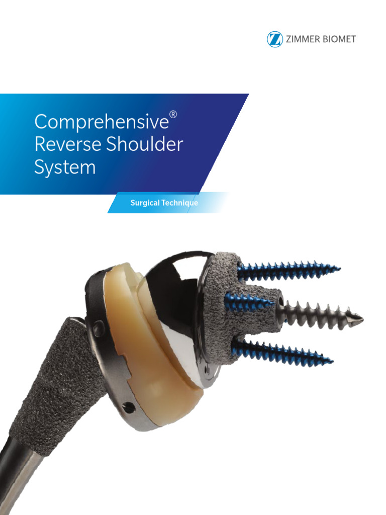 HOMBRO DE REVERSA Biomet | PDF | Shoulder | Human Anatomy