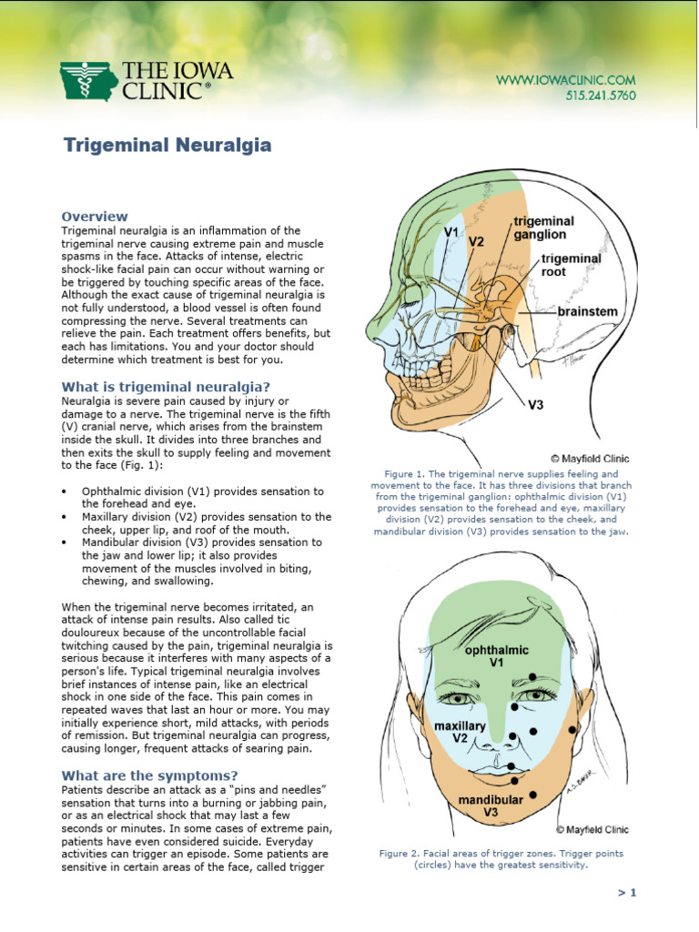 Trigeminal Neuralgia | PDF | Pain | Medicine Trigeminal Neuralgia | PDF | Pain | Medicine