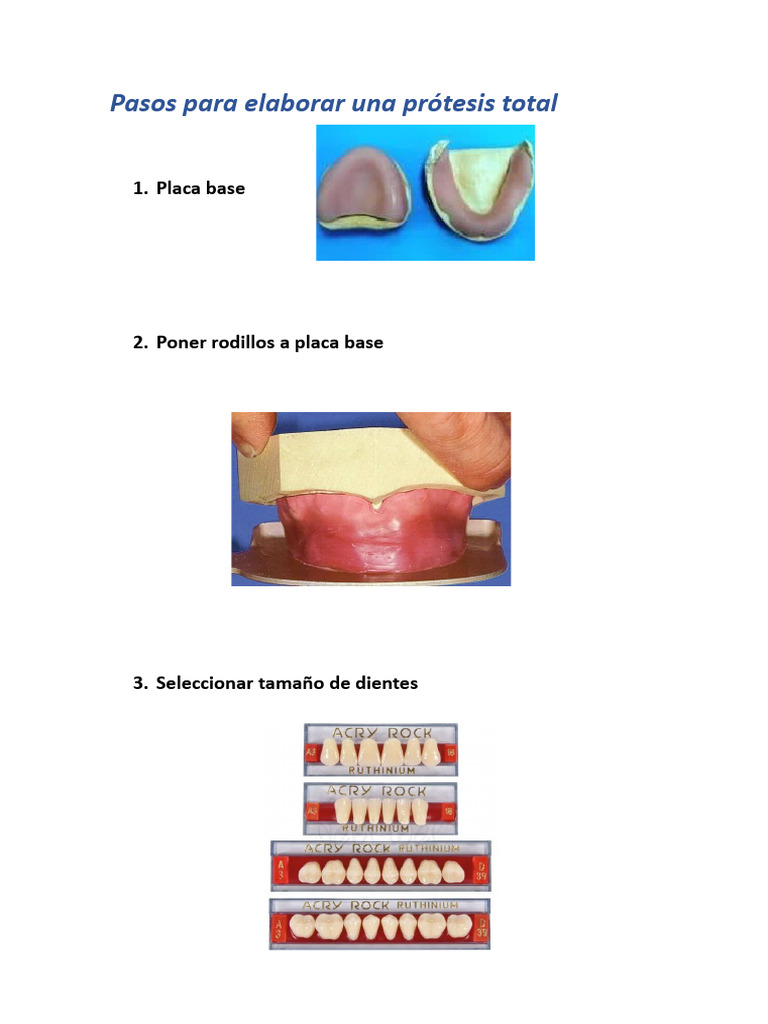 Protesis Total Paso A Paso | PDF