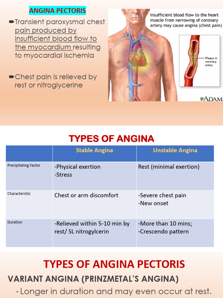 Angina and Myocardial Infarction | PDF | Myocardial Infarction ...