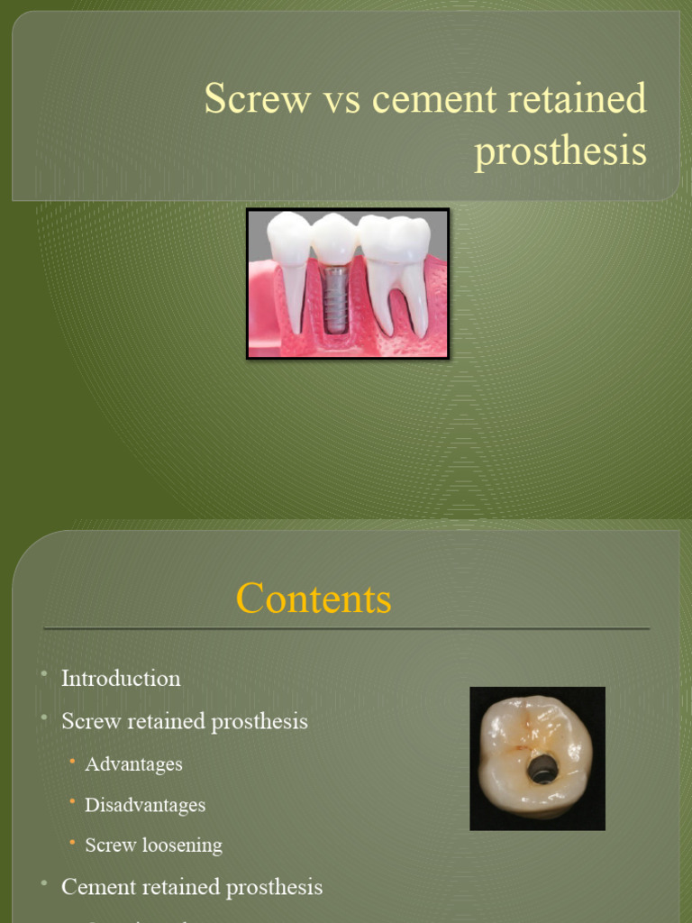 Screw Retained Vs Cement Retained Prosthesis | Download Free PDF | Dental Implant | Prosthesis