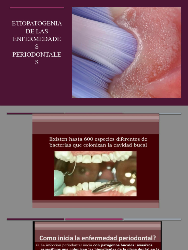 Etiopatogenia de Las Enfermedades Periodontales | PDF | Ciencia y matemáticas