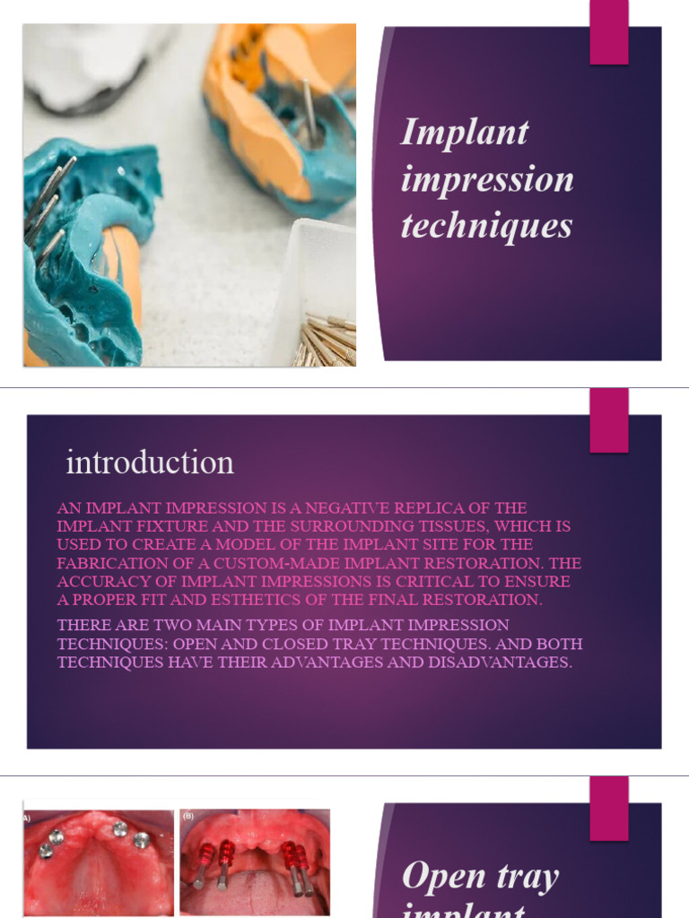 Implant Impression Techniques Pdf Dental Implant Medical Specialties