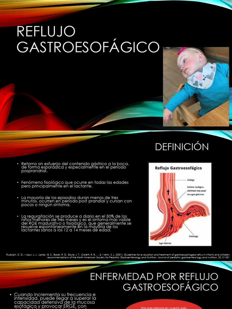 Reflujo Gastroesofágico | PDF | Enfermedades digestivas | Enfermedades ...
