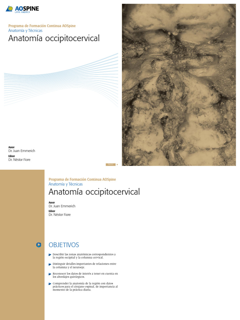 AO Anatomia y Tecnicas Occipitocervical | PDF | Vértebra | La columna ...