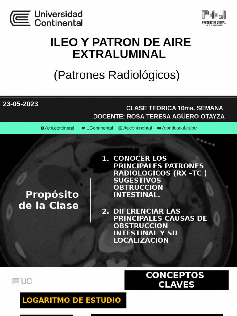 Clase 10 - Ileo y Aire Extraluminal | PDF | Abdomen | Intestino grueso