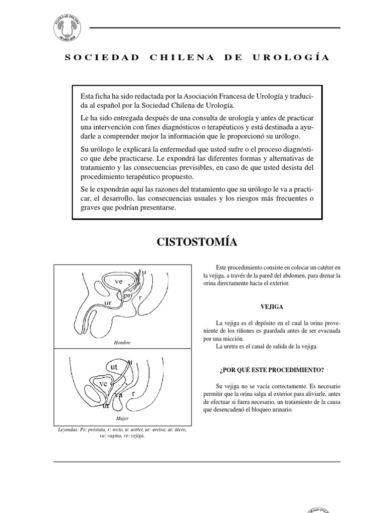 Cistostomía: Procedimiento para colocar un catéter en la vejiga a ...