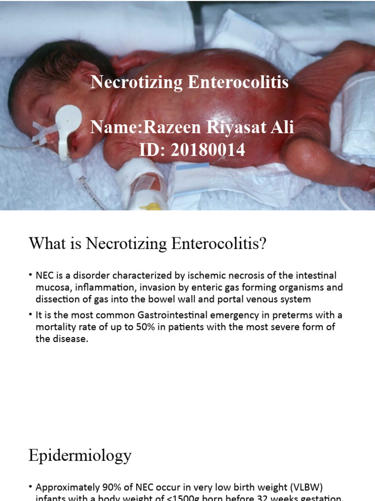 Necrotizing Enterocolitis | PDF | Medical Specialties | Clinical Medicine