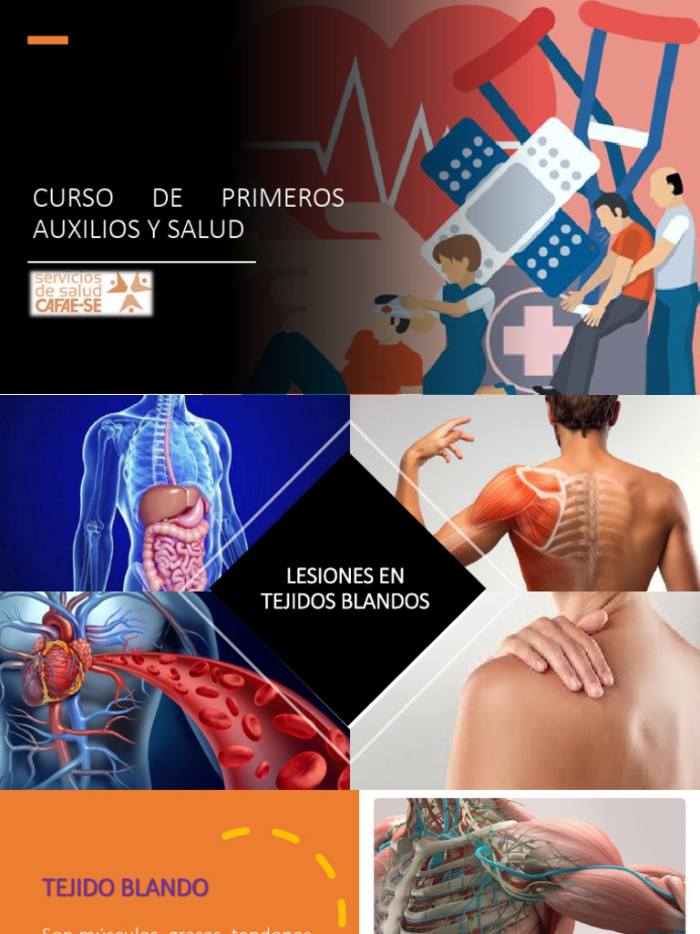 Lesiones de Tejidos Blandos (Herida) | PDF | Primeros auxilios | Medicina CLINICA