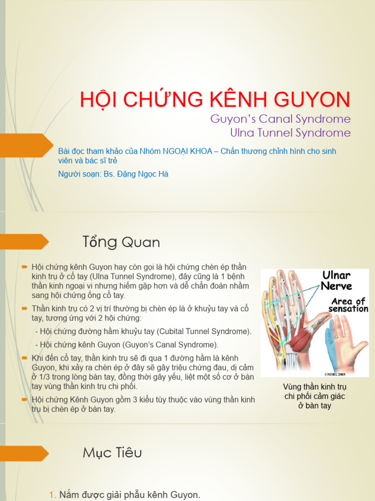 H I CH NG Kênh Guyon | PDF