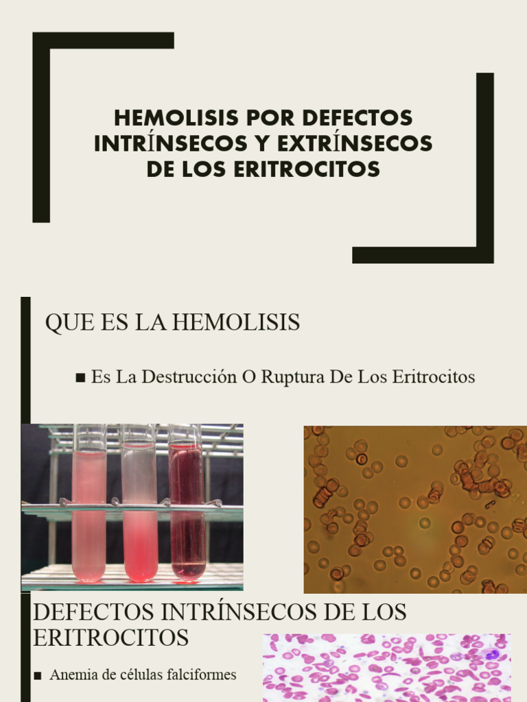 Hemolisis Por Defectos Intrínsecos y Extrínsecos Eritrositos | PDF