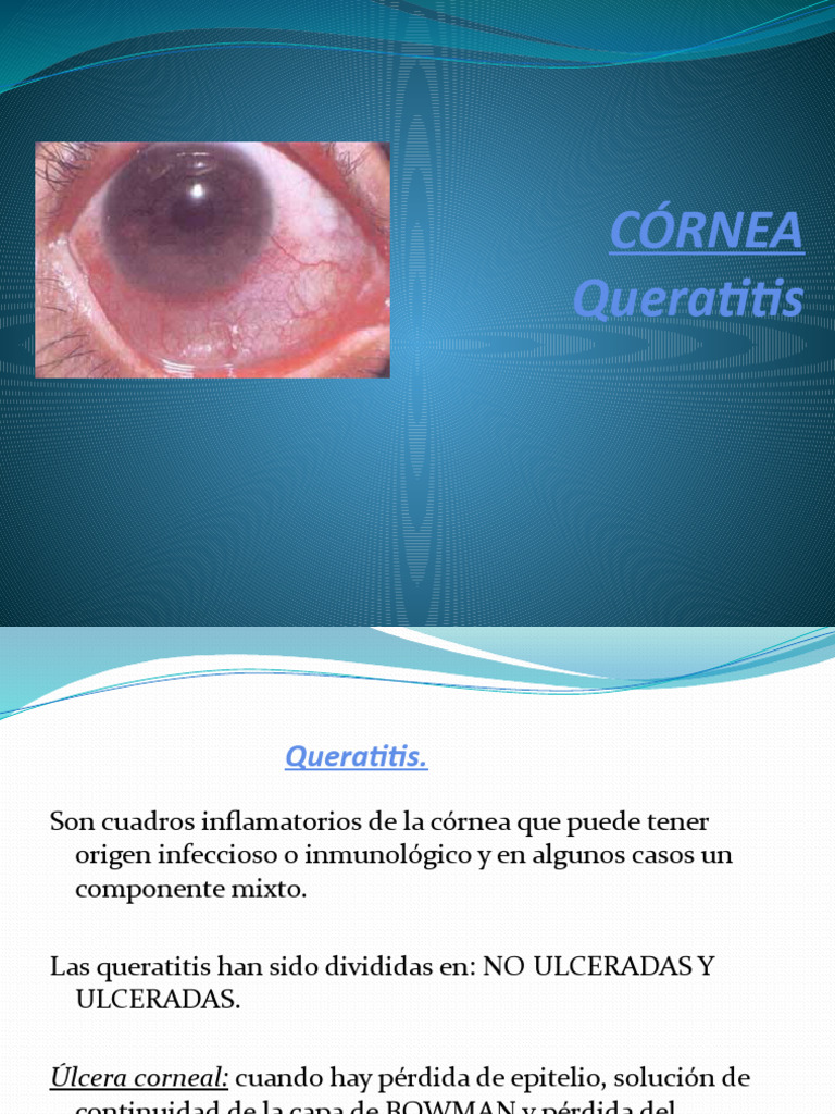 Guía Completa sobre Queratitis y Tratamientos | PDF | Córnea ...