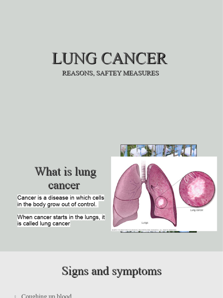 Lung Cancer | PDF
