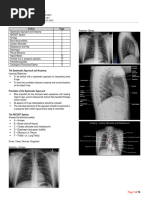 Chest X-Ray Abnormalities - Costophrenic Angle Blunting | PDF ...