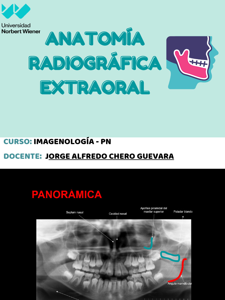 Anatomía Radiografícas Extraorales | PDF